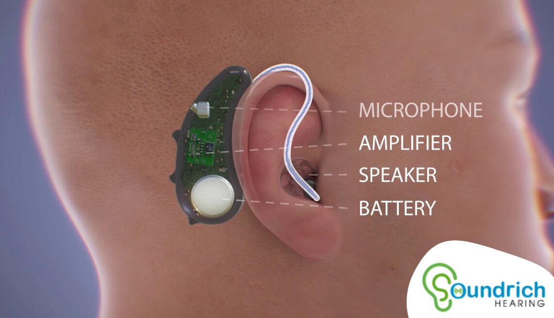 Enhance your Hearing with the Latest Hearing Aid Technology - Soundrich ...